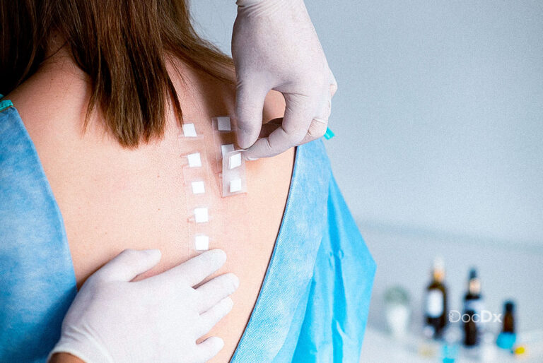 Allergy Testing What to Expect & How It Works | Blog | DocDx